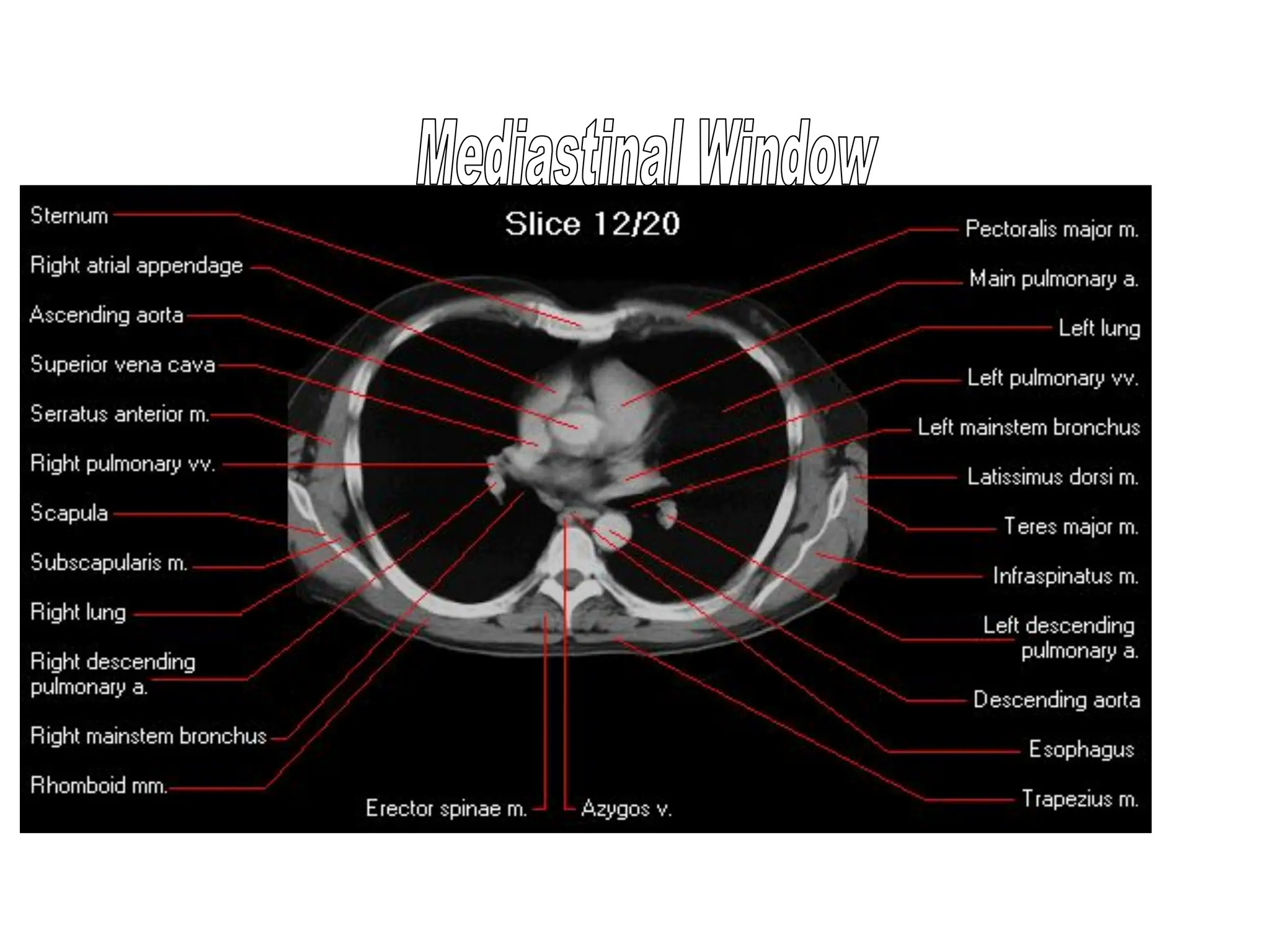 CT SCAN THORAX.pdf