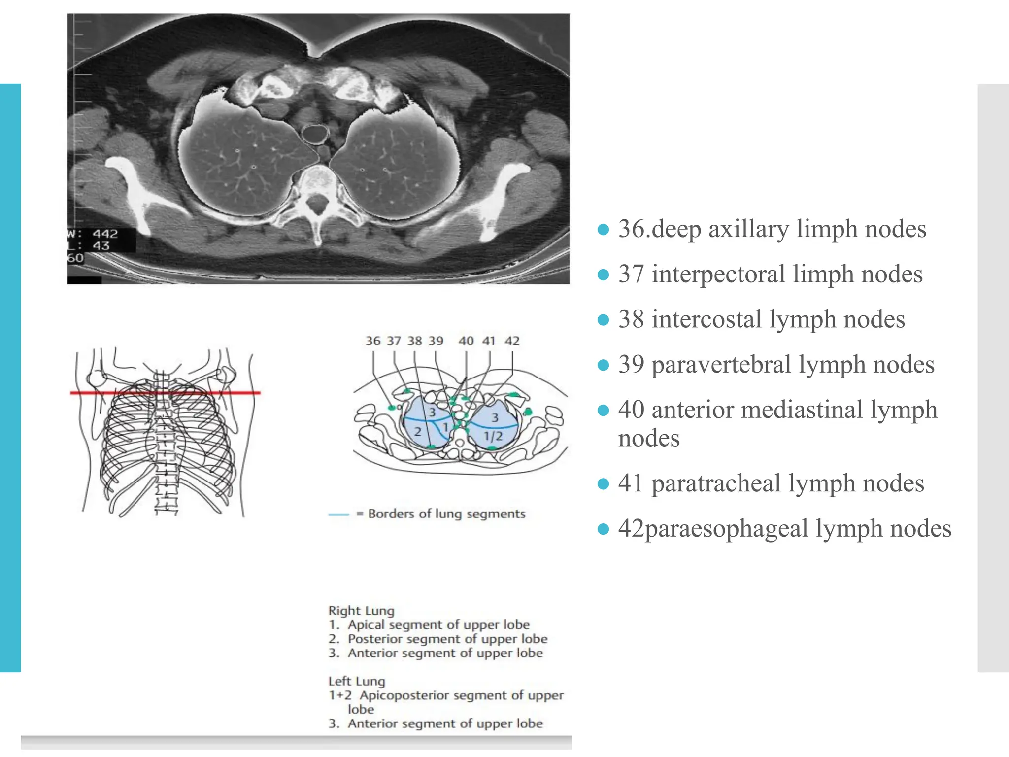 CT SCAN THORAX.pdf