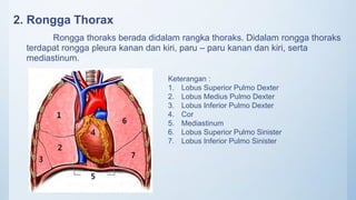 ppt aplikasi klinis Ct-scan thorax pada kasus Corpus Alienum | PPTX