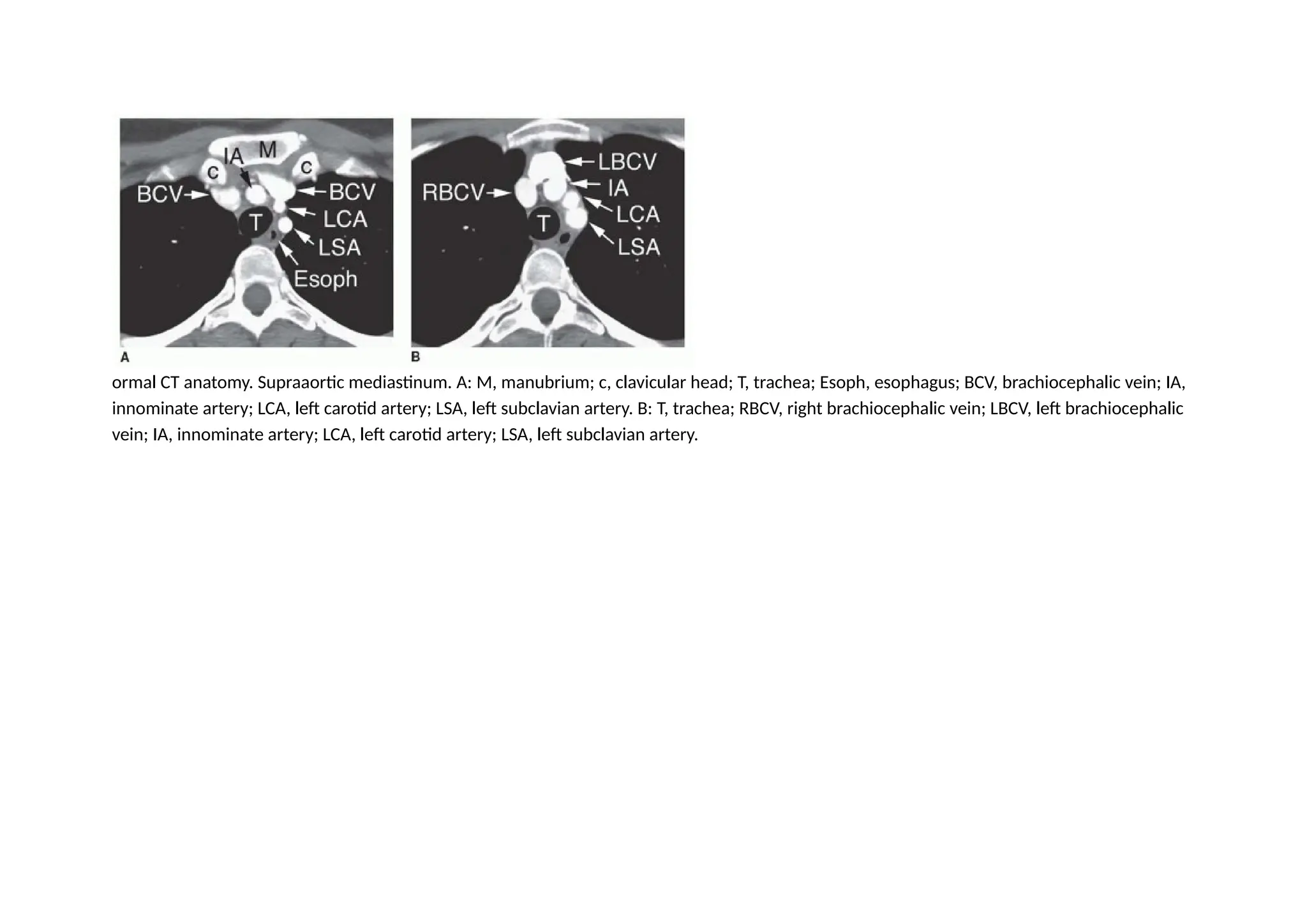 CT Scan Toraks.docx kjdfkldjrejlkejdlkswejhrjerh | DOCX