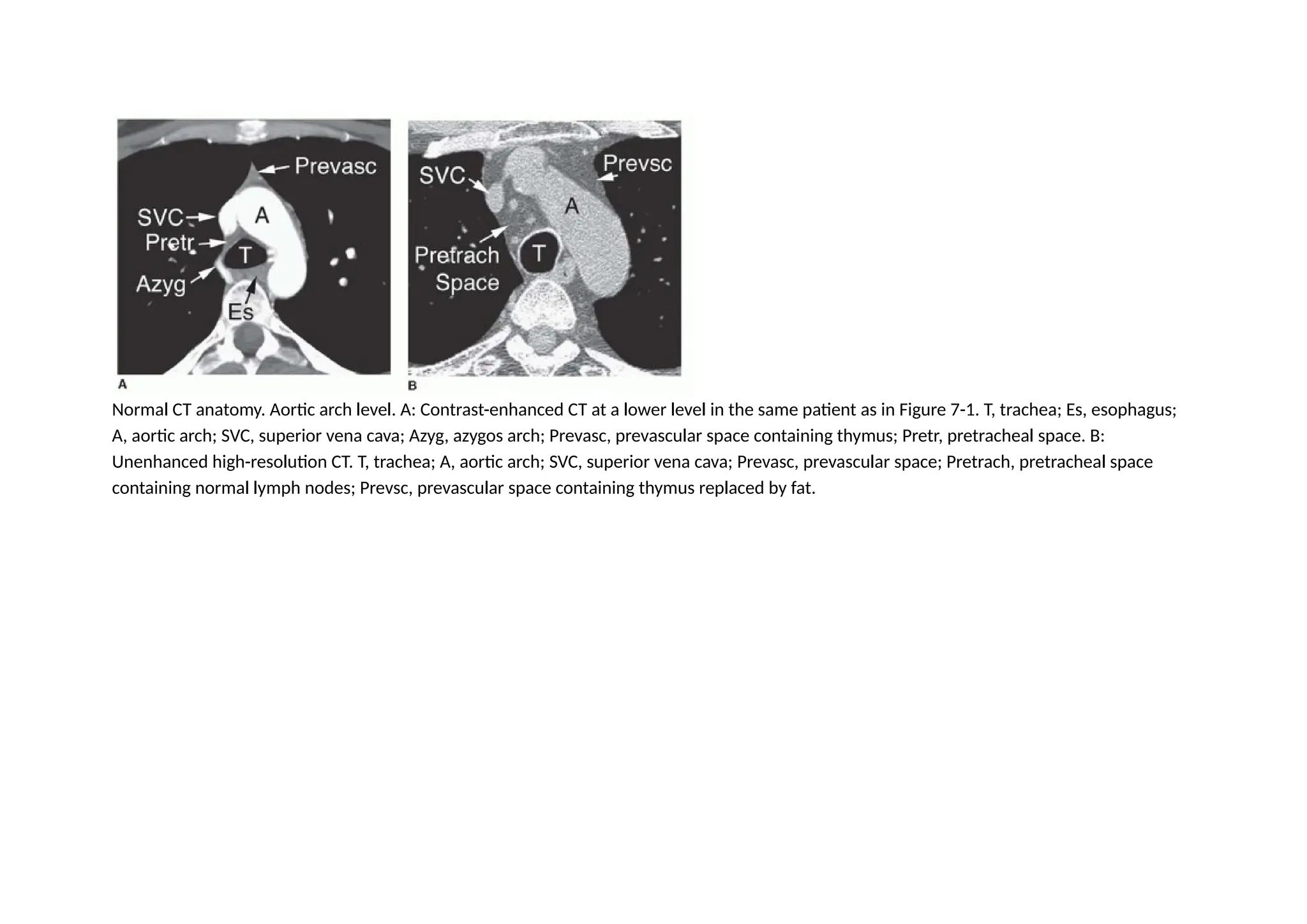 CT Scan Toraks.docx kjdfkldjrejlkejdlkswejhrjerh | DOCX