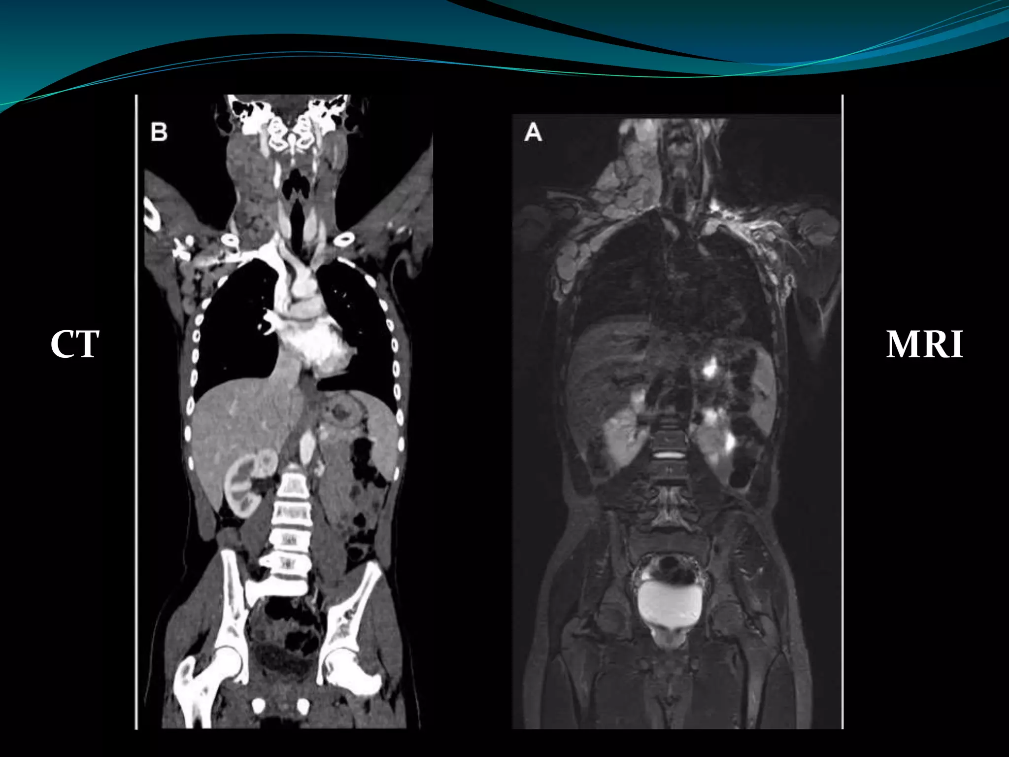CT Scan Vs MRI Scan | PPTX