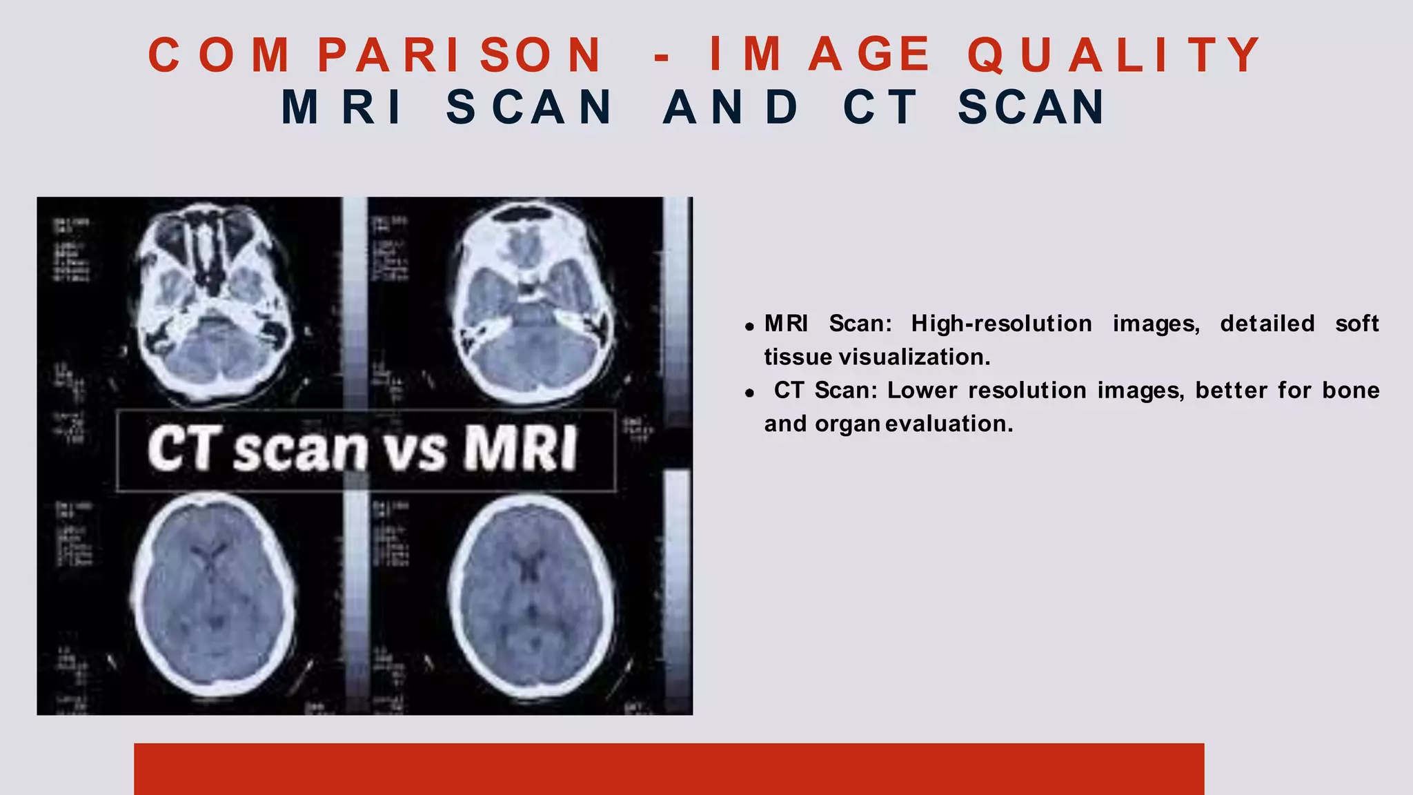 CT Scan vs MRI Scan A Comparative Analysis-sanjivinidiagnostics.pptx