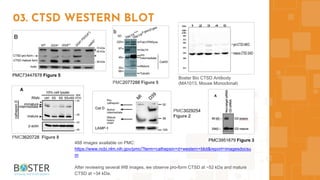 Learn CTSD in 3 minutes | Cathepsin D | PPT