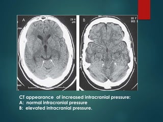 CT imaging of Brain in Clinical Practice by Dr. Vaibhav Yawalkar | PPTX