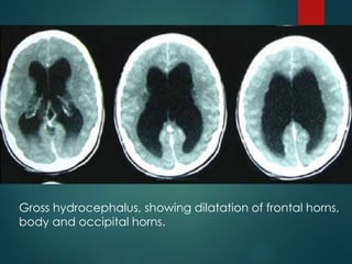 CT imaging of Brain in Clinical Practice by Dr. Vaibhav Yawalkar | PPTX