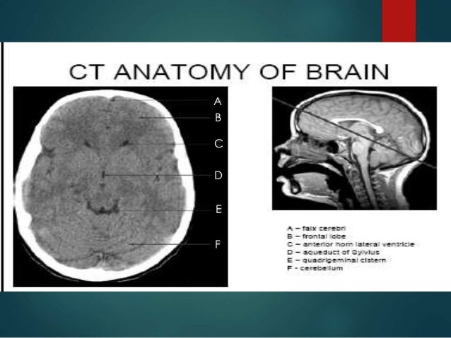 CT imaging of Brain in Clinical Practice by Dr. Vaibhav Yawalkar