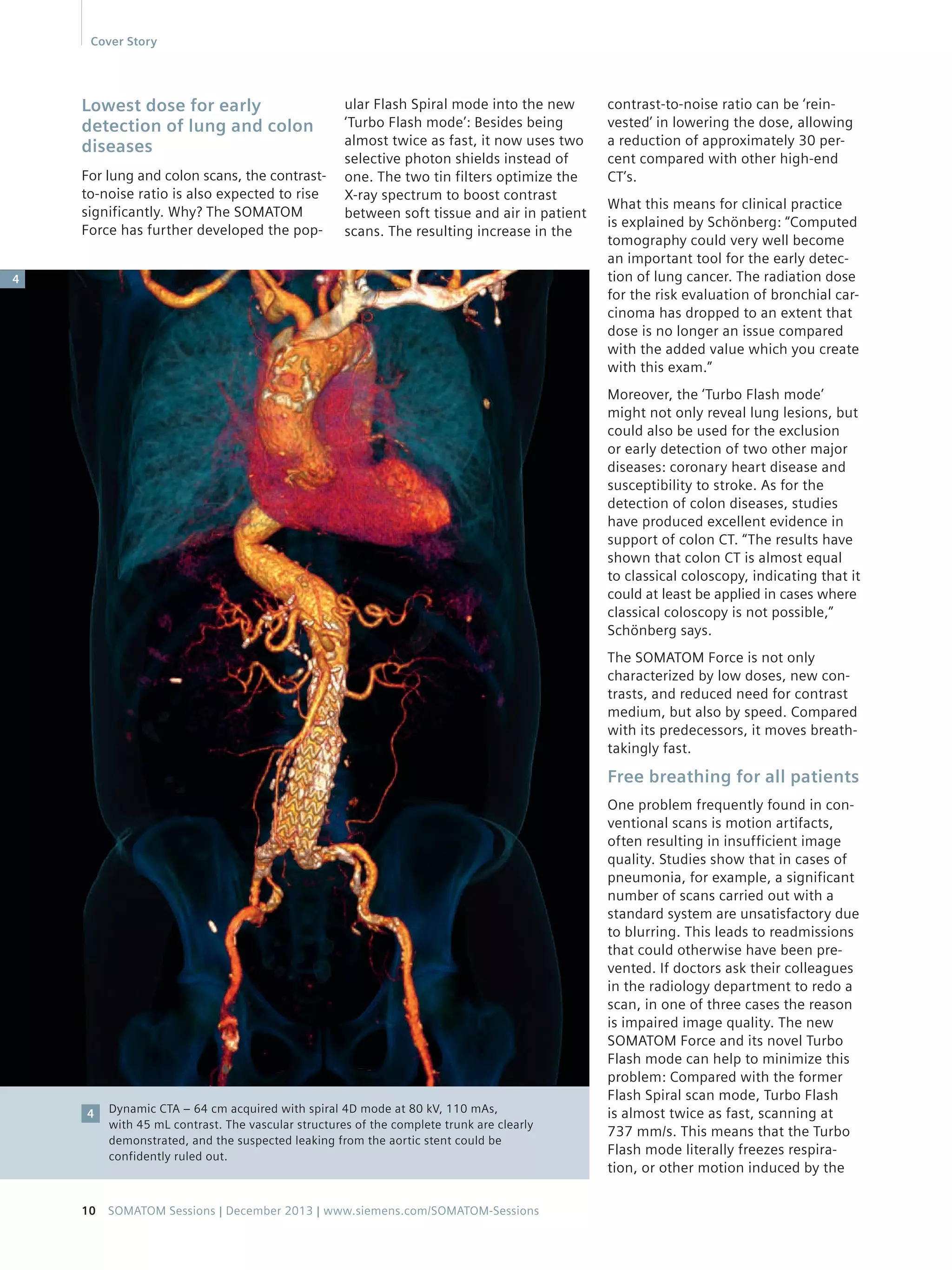 Ct somatom sessions-33 | PDF