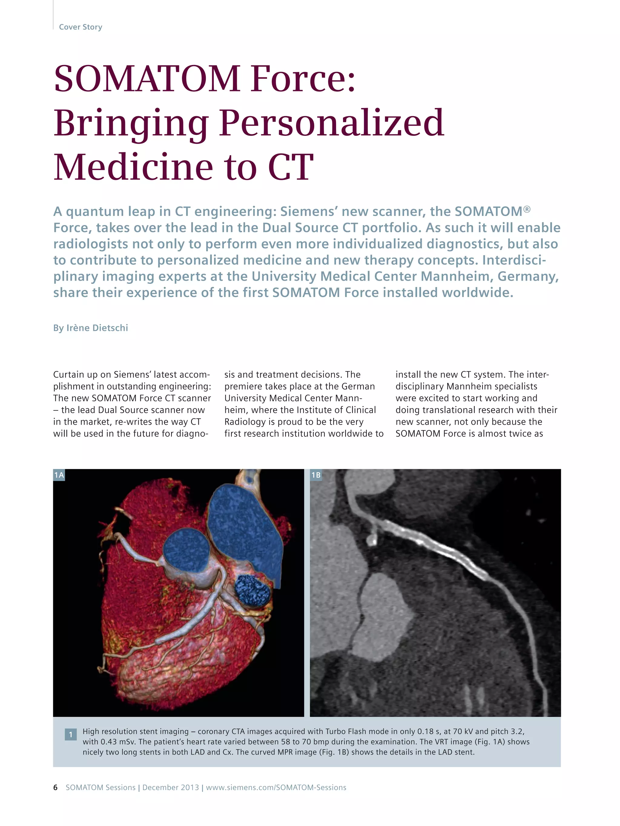 Ct somatom sessions-33 | PDF