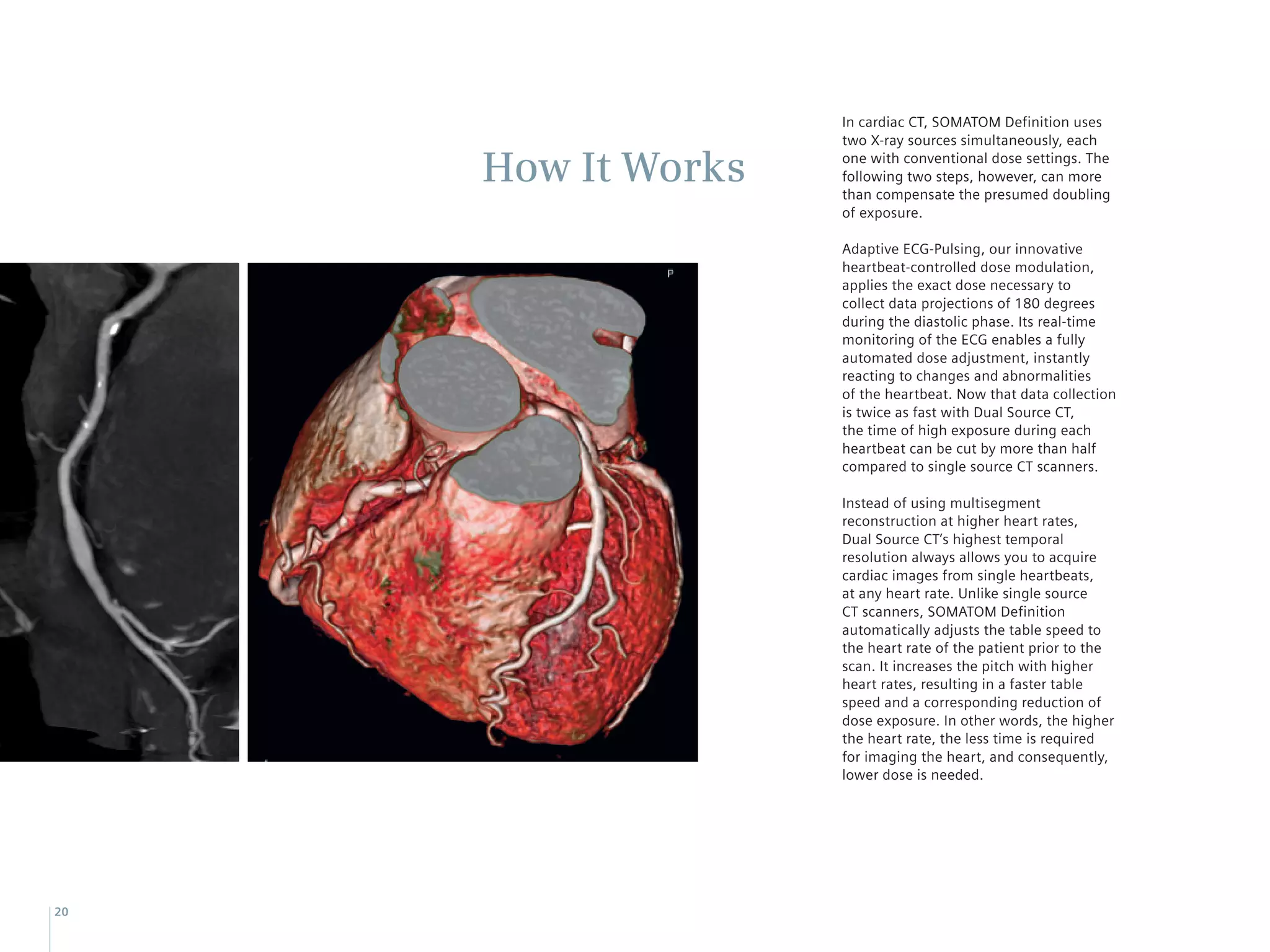 CT Somatom Definition - Dual Source - SIEMENS | PDF