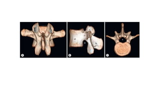 Comprehensive Overview of CT-Spine Imaging and Vertebral Anatomy | PDF