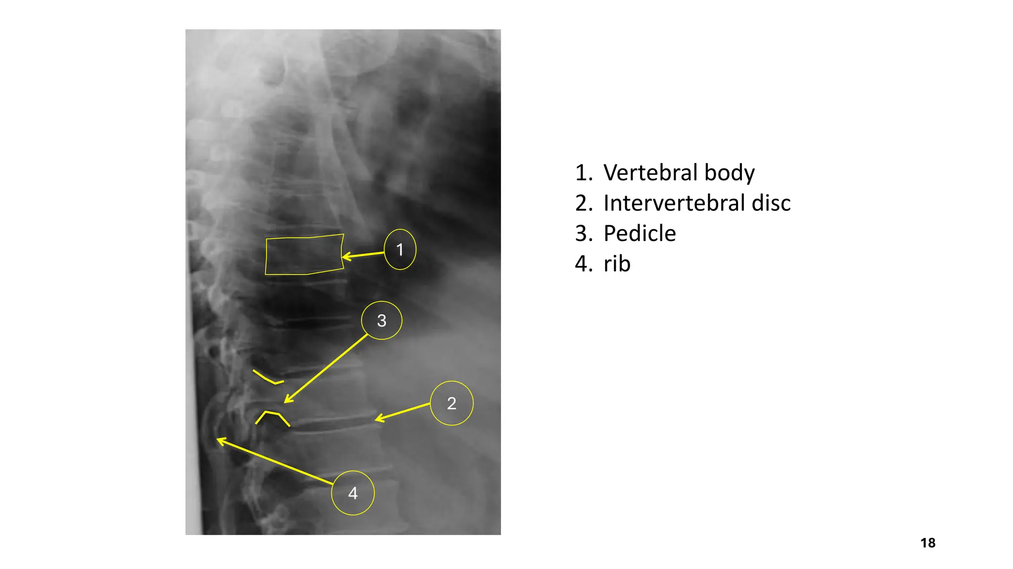 radiological anatomy of the spine S3 applied medical science | PPT