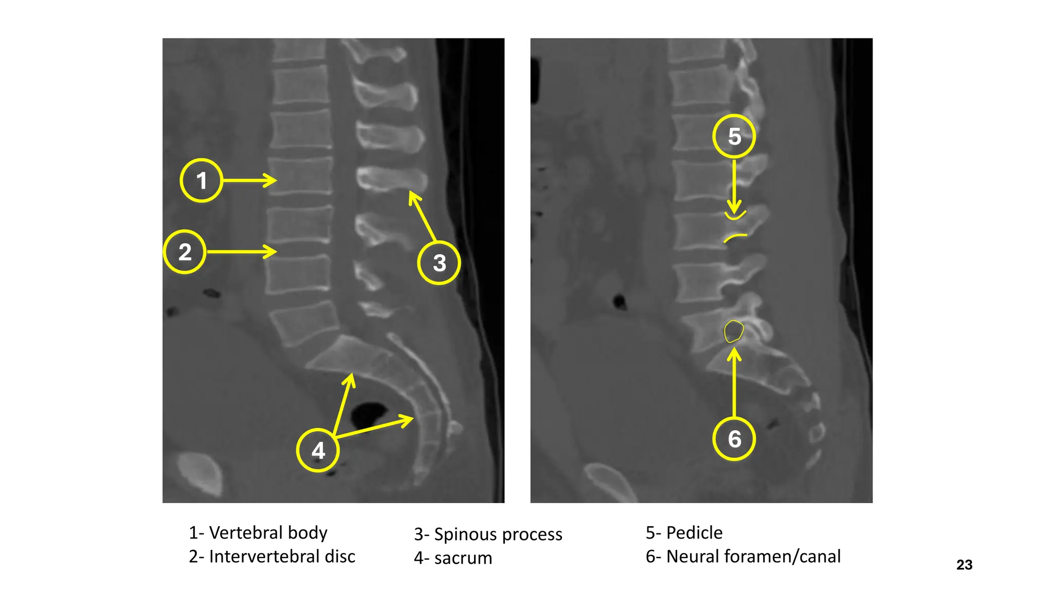 radiological anatomy of the spine S3 applied medical science | PPT