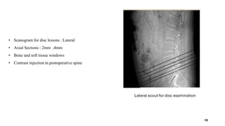 radiological anatomy of the spine S3 applied medical science | PPT