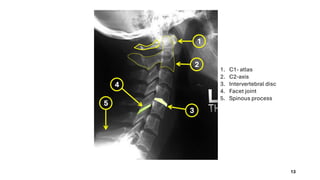 radiological anatomy of the spine S3 applied medical science | PDF