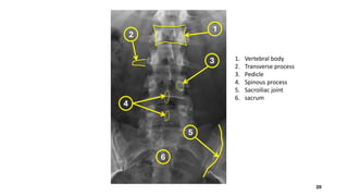 radiological anatomy of the spine S3 applied medical science | PDF