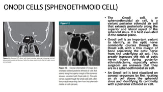 CT SPN dengan penjelasan secara anatomi.pdf