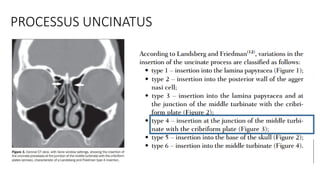 CT SPN dengan penjelasan secara anatomi.pdf