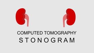 CT Stonogram | PPTX | Medical Tests | Medical Health
