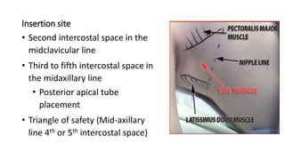 Closed tube thoracotomy drainage presentation | PPT