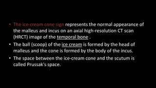 Ct temporal bone | PPTX