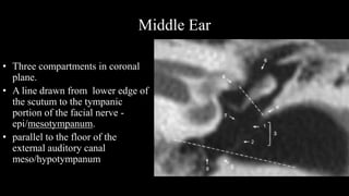 Ct temporal bone | PPTX