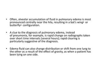 Alveolar lung disease | PPTX