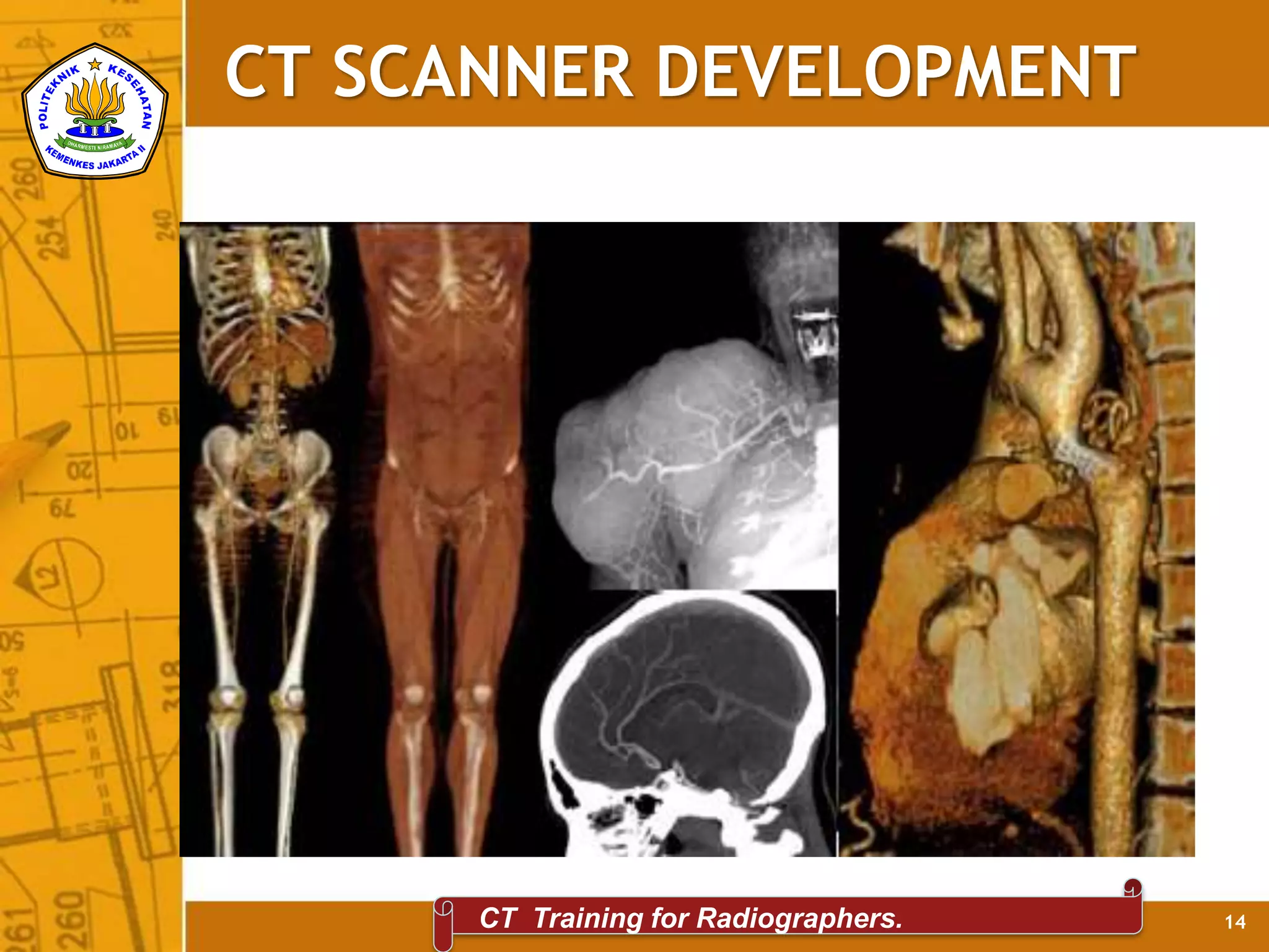 PHYSICS of COMPUTED TOMOGRAPHY | PDF