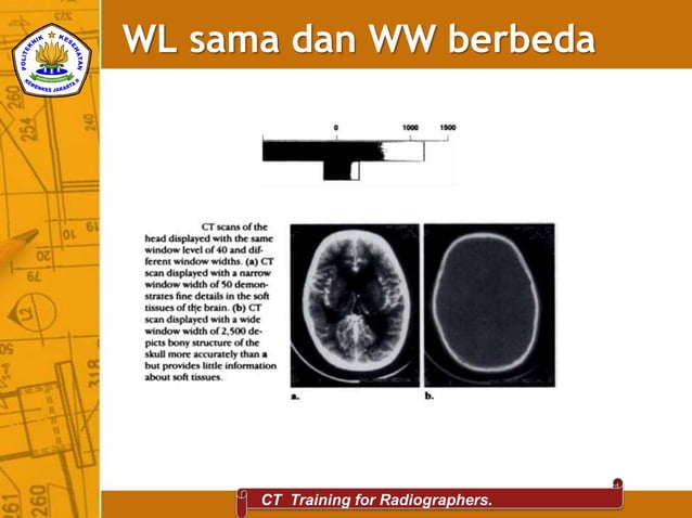 PHYSICS of COMPUTED TOMOGRAPHY | PDF | Medical Tests | Medical Health