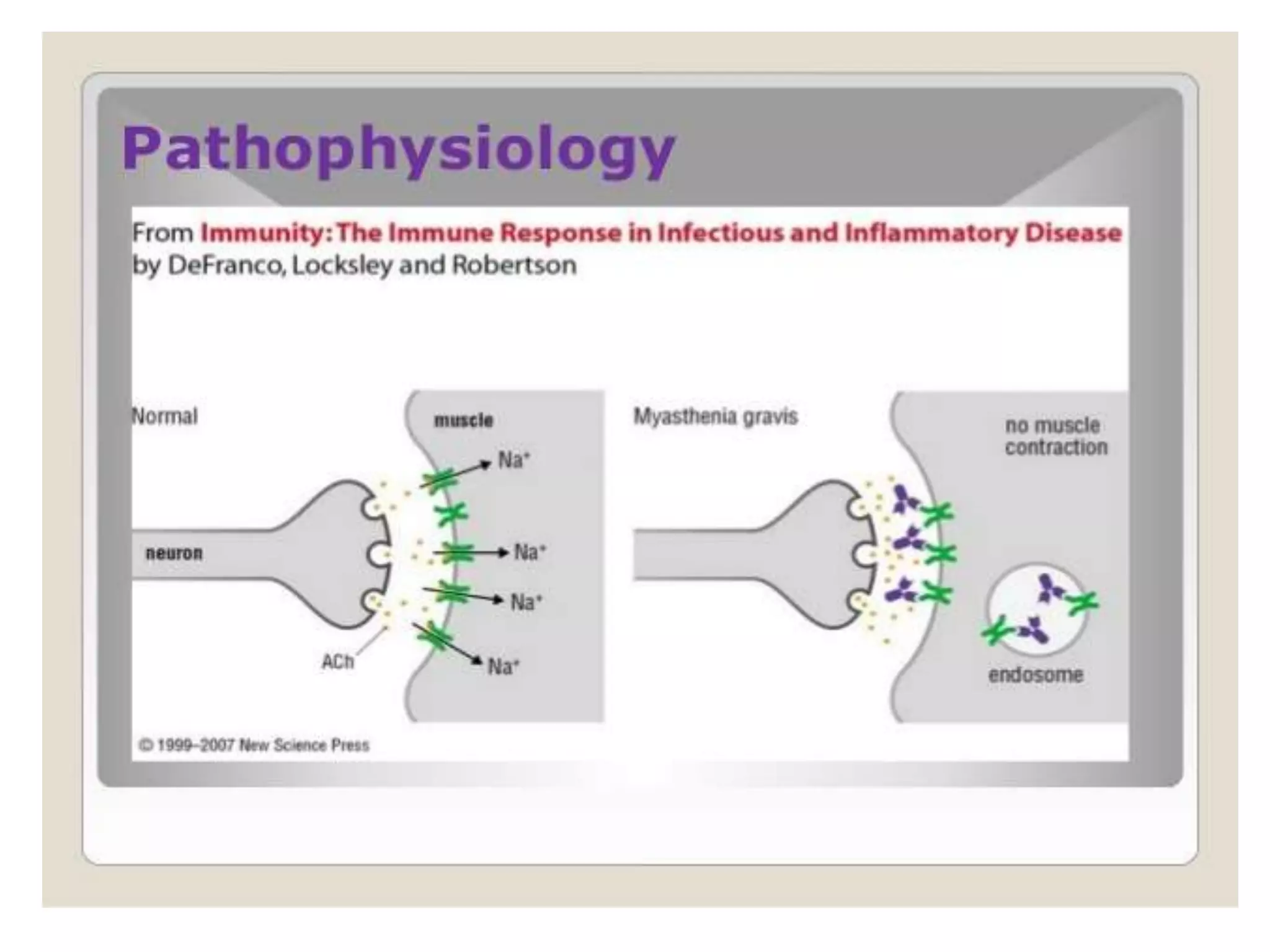 Management Of Myasthenia Gravis | PPTX