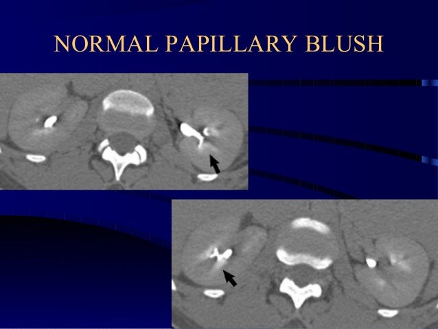 CT UROGRAPHYvFROM SEEING TO UNDERSTANDING