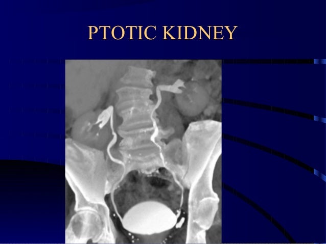 CT UROGRAPHY FROM SEEING TO UNDERSTANDING