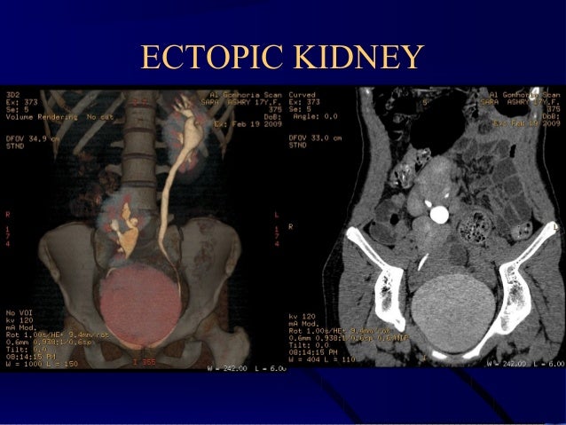 CT UROGRAPHYvFROM SEEING TO UNDERSTANDING