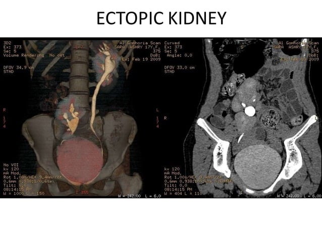 CT Urography | PPTX | Medical Tests | Medical Health
