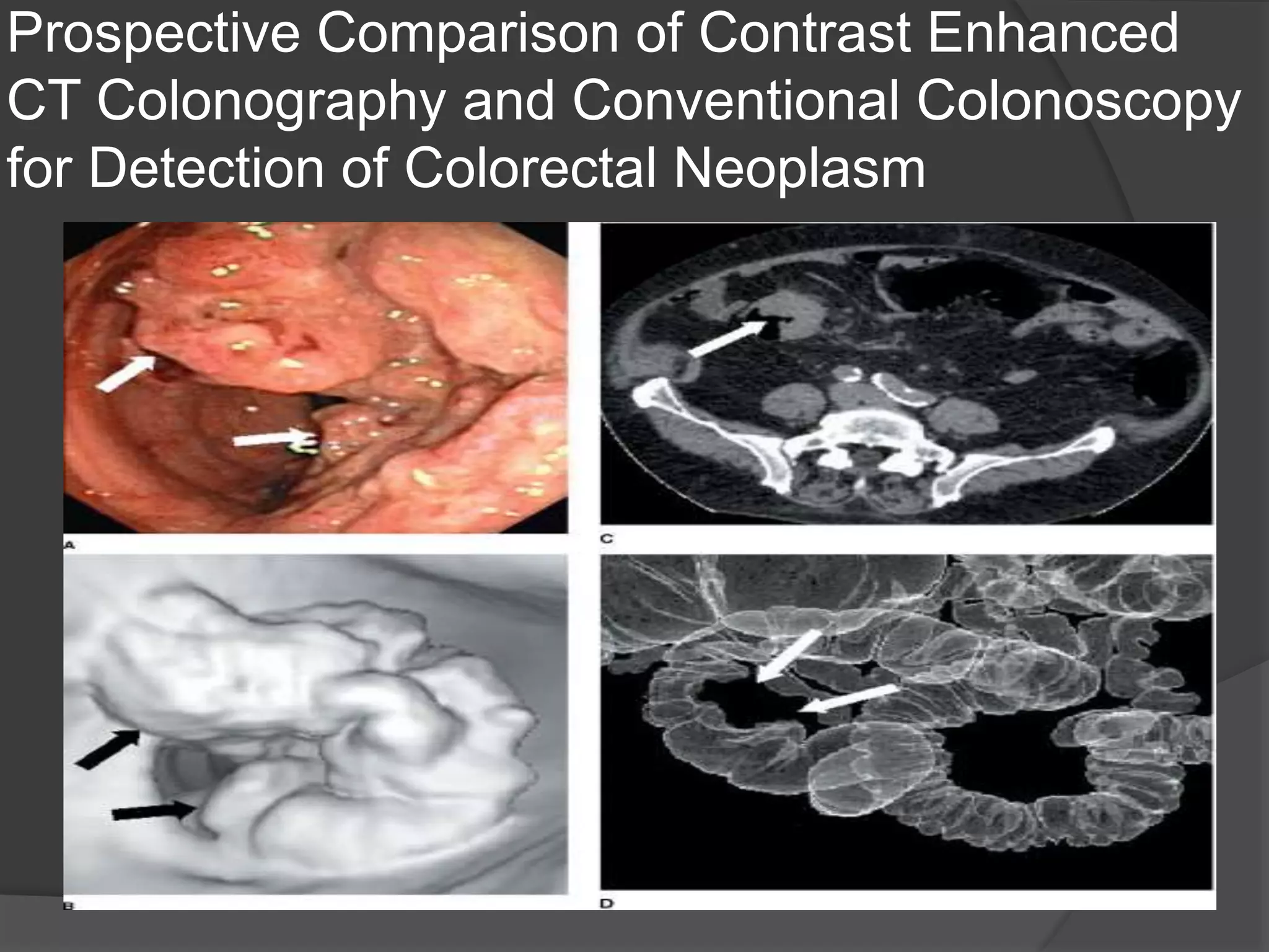 Ct virtual endoscopy 1 | PPTX