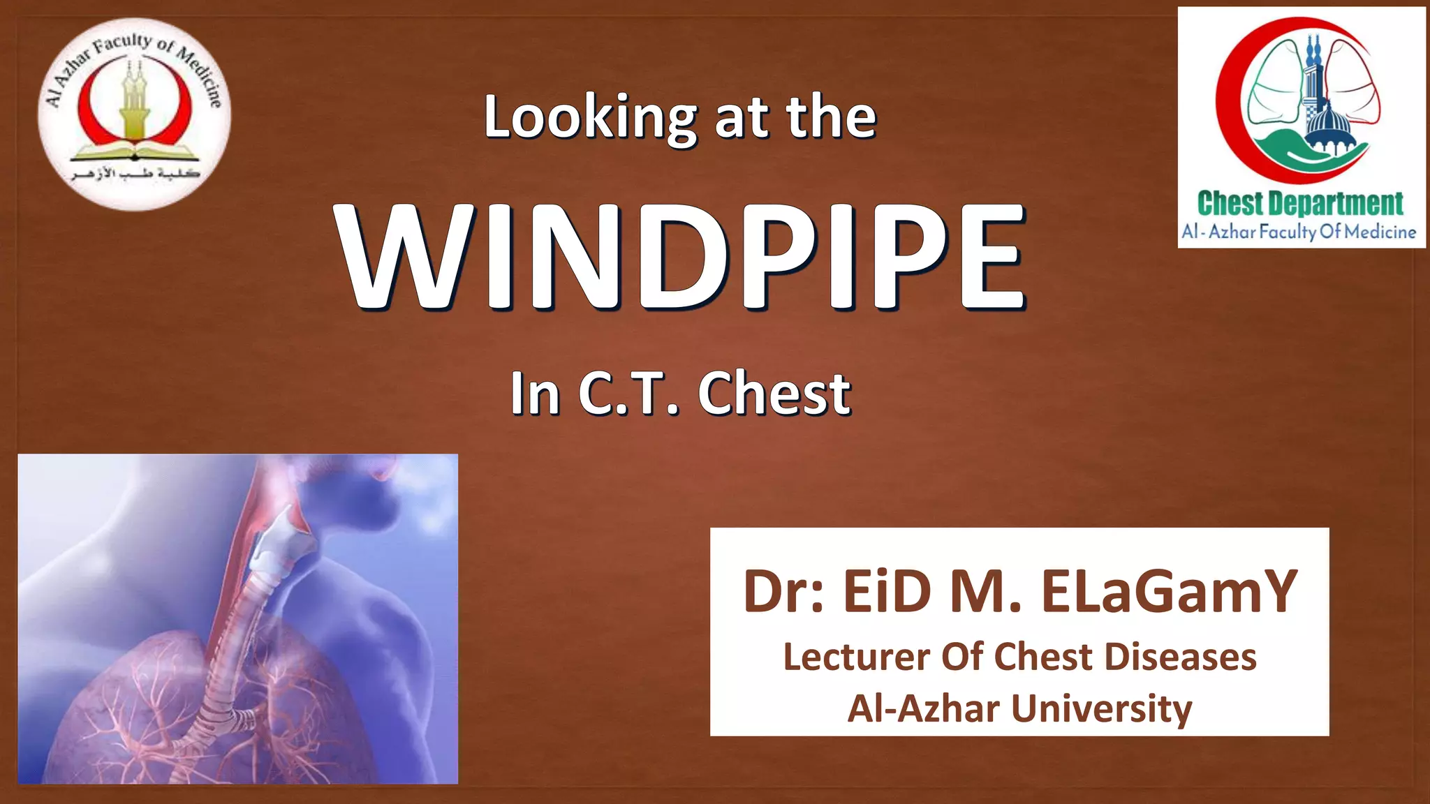 Looking at the windpipe in CT chest (dr eid elagamy).pptx | Lung and ...