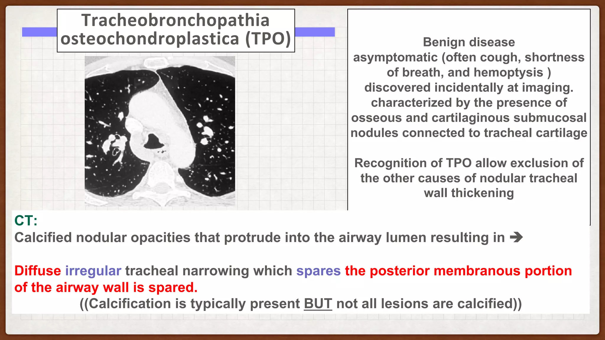 Looking at the windpipe in CT chest (dr eid elagamy).pptx | Lung and ...
