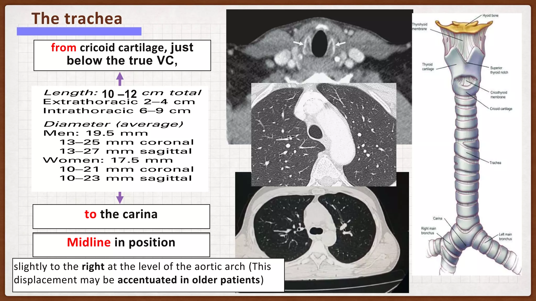 Looking at the windpipe in CT chest (dr eid elagamy).pptx | Lung and ...