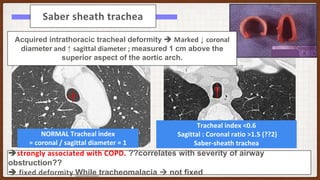 Looking at the windpipe in CT chest (dr eid elagamy).pptx | Lung and ...