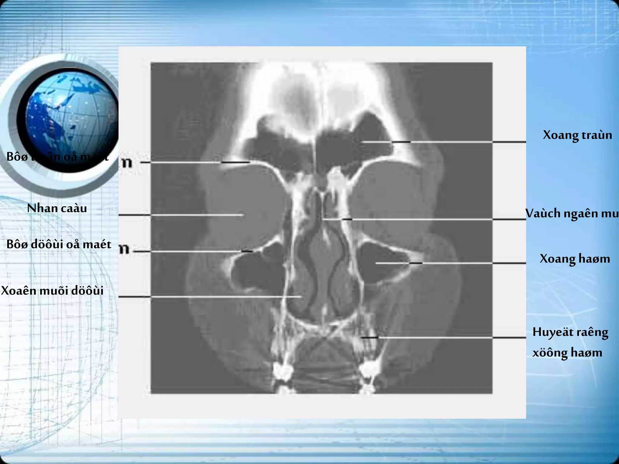 Ct xoang hd | PPT