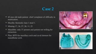 Cu-Sil Dentures in prosthodontics a Journal club | PPT