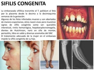 Cuadro clinico de sifilis | PPTX