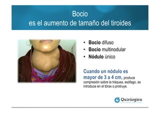 ¿Cuando se opera de tiroides? | PDF