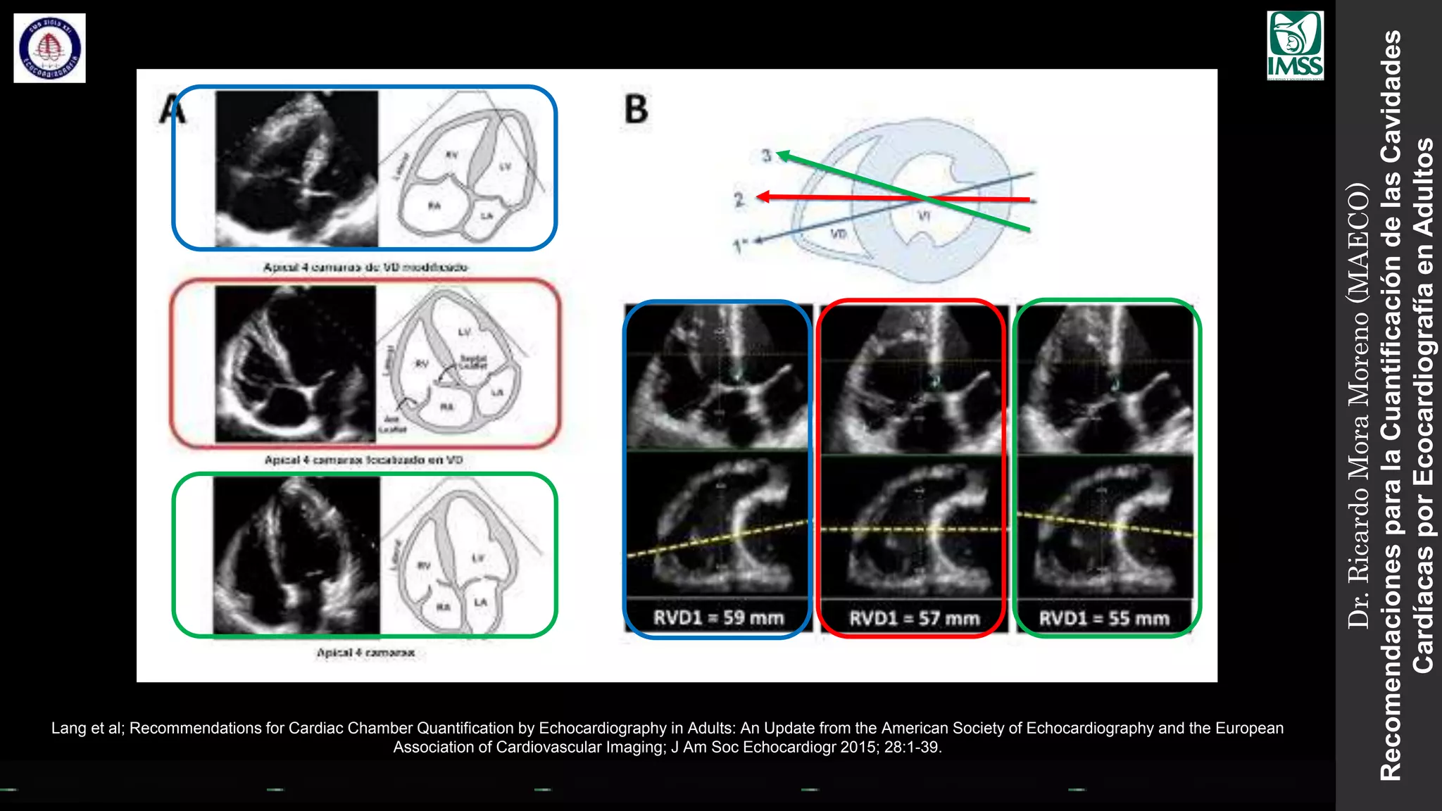 Recomendaciones Cuantificacion para medicion de camaras cardiacas por ...