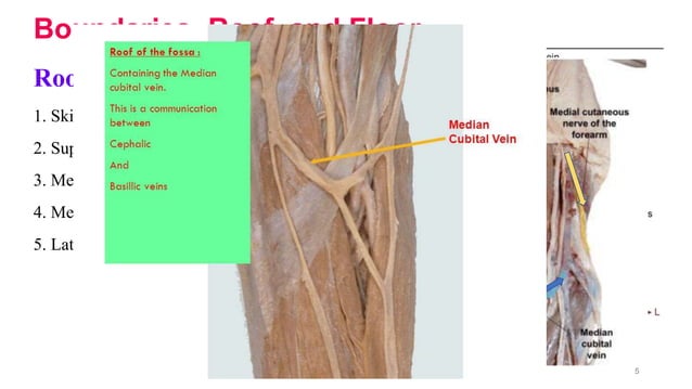 Cubital Fossa.pptx | Death, Injury, or Military Conflict | Sensitive Topics