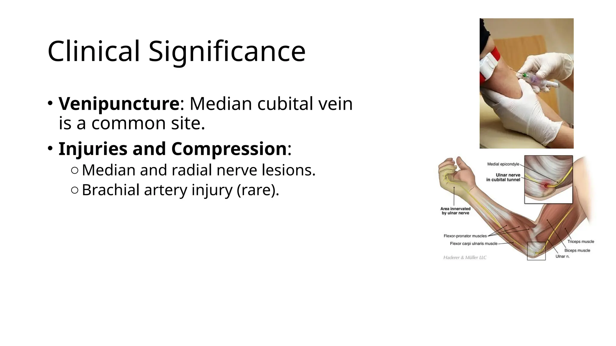 Cubital Fossa, transition zone for neurovascular structures | PPTX