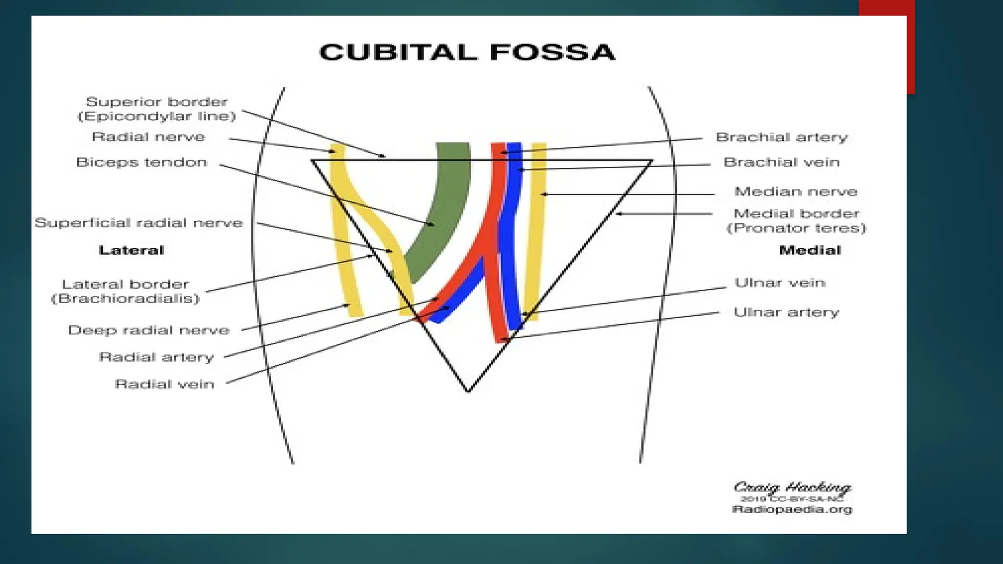 Gross Anatomy of the Cubital Fossa and its Contents | PPTX