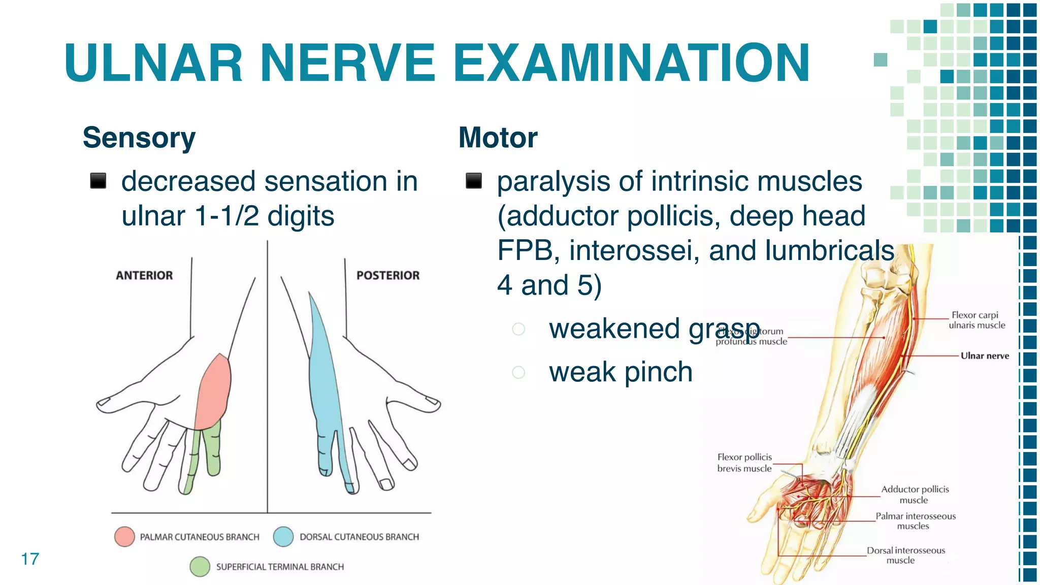 Cubital tunnel syndrome 1 | PDF