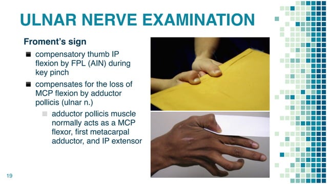 Cubital tunnel syndrome 1 | PPT