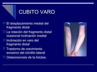 Cubito varo | PPT
